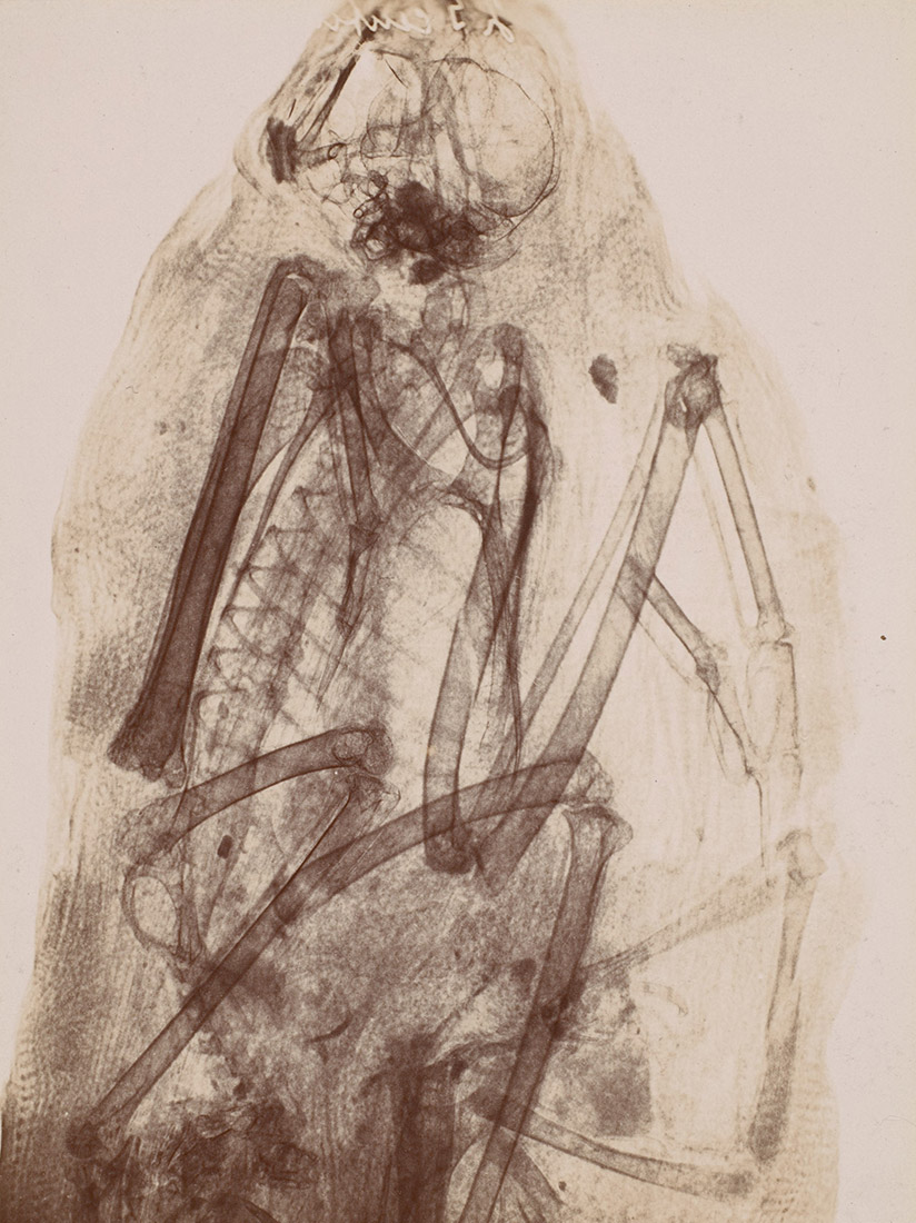 The Discovery of the X-ray and How it Impacted the Modern World ...